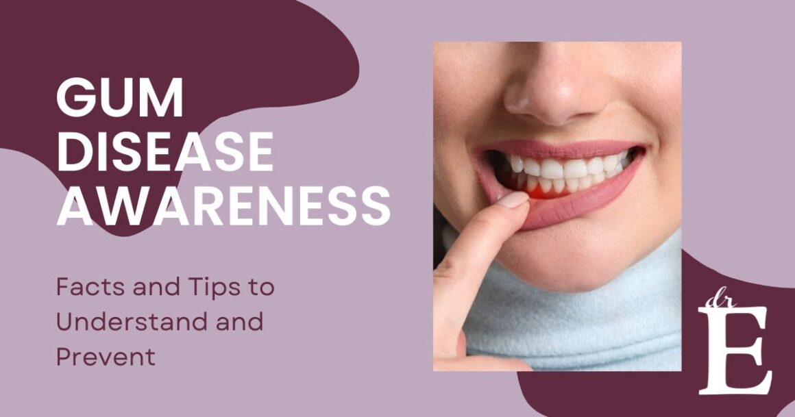 Gum Disease Awareness Month: Facts and Tips - Dr. E Dentistry